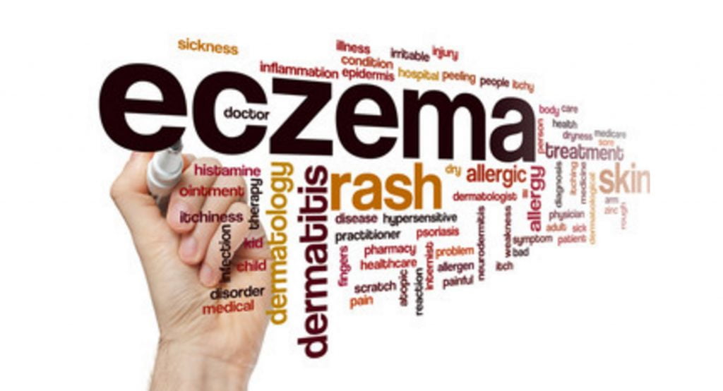 ekzema | Dermatologijos klinika Vilniuje